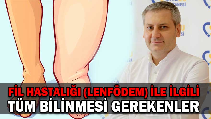 FİL HASTALIĞI (LENFÖDEM) NEDİR? LENFÖDEM BELİRTİLERİ NELERDİR, NASIL ...